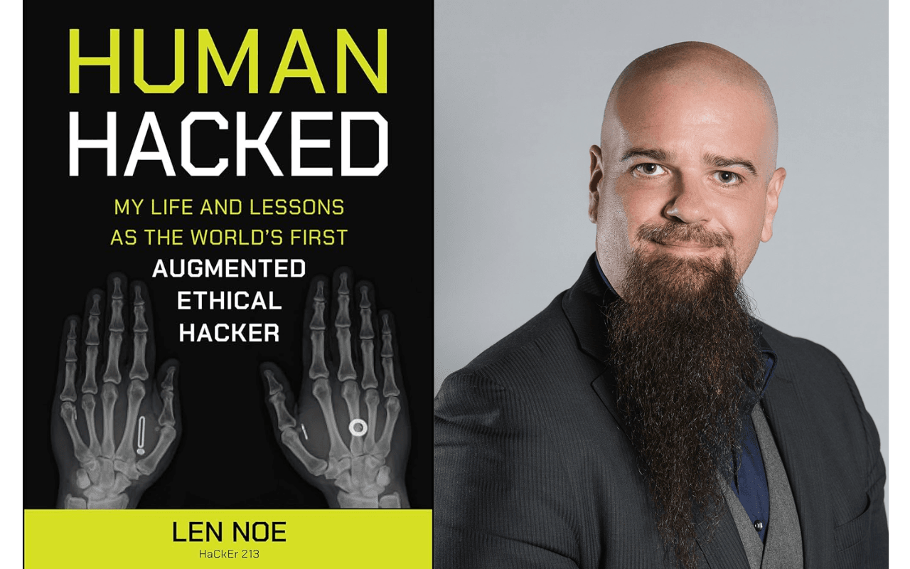 Human Hacked: Cyber Risks And Rewards Of Bio-Implants